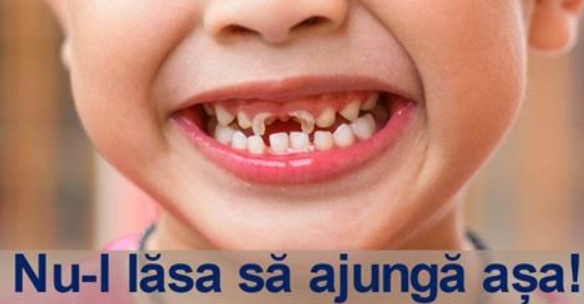 Cum să-l ferești de carii - REVISTA BABY: Pentru părinti și copii