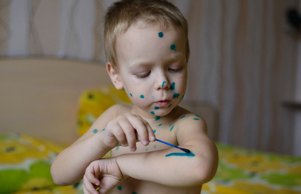 Care sunt diferențele între principalele boli ale copilăriei - REVISTA ...